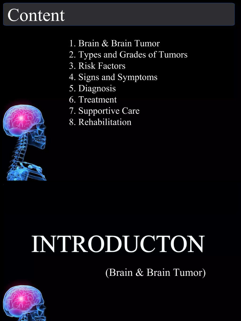 Brain Tumor | PDF
