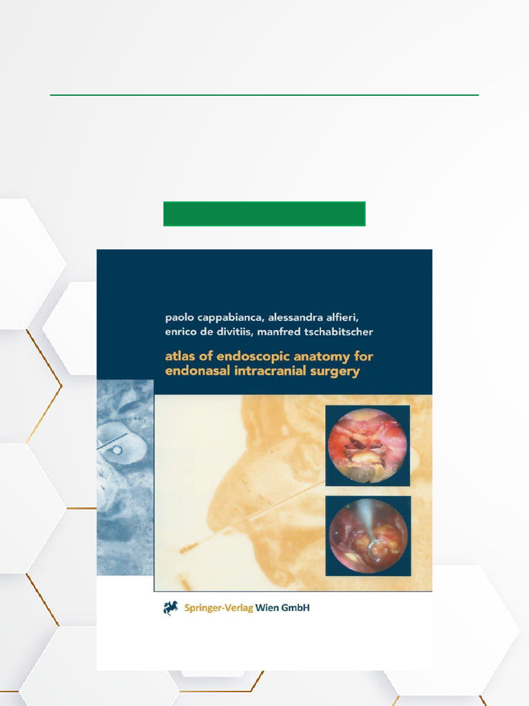 Atlas of Endoscopic Anatomy For Endonasal Intracranial Surgery Full PDF ...