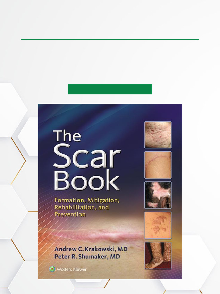 The Scar Book Formation, Mitigation, Rehabilitation and Prevention ...