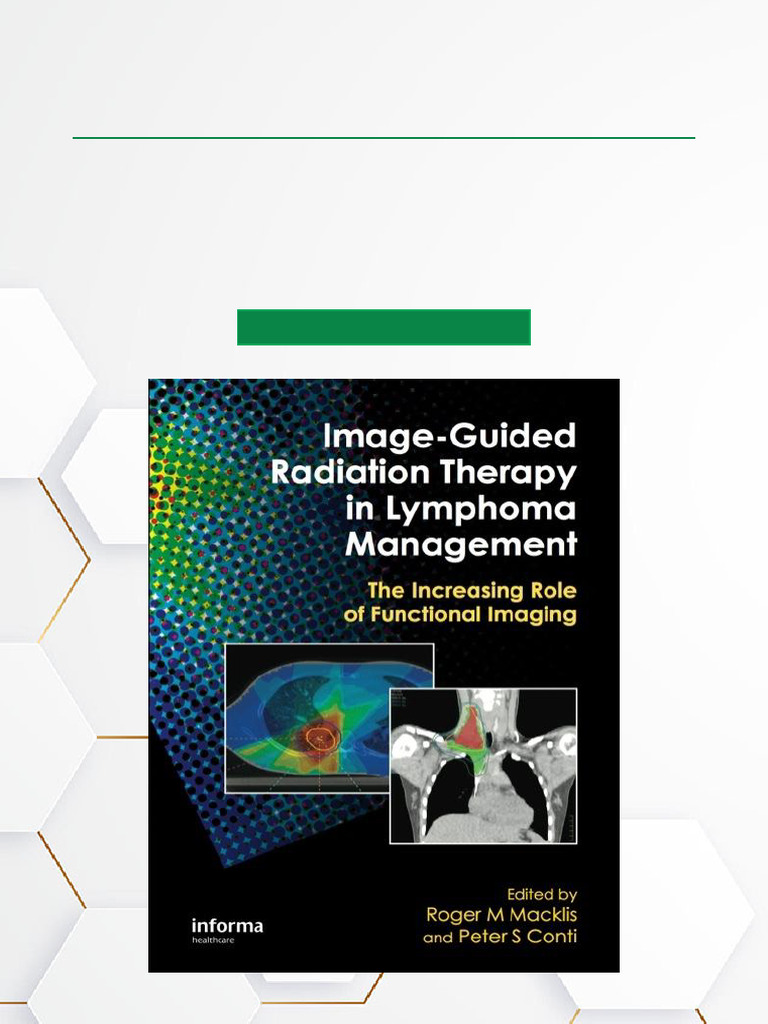 Image Guided Radiation Therapy in Lymphoma Management The Increasing ...
