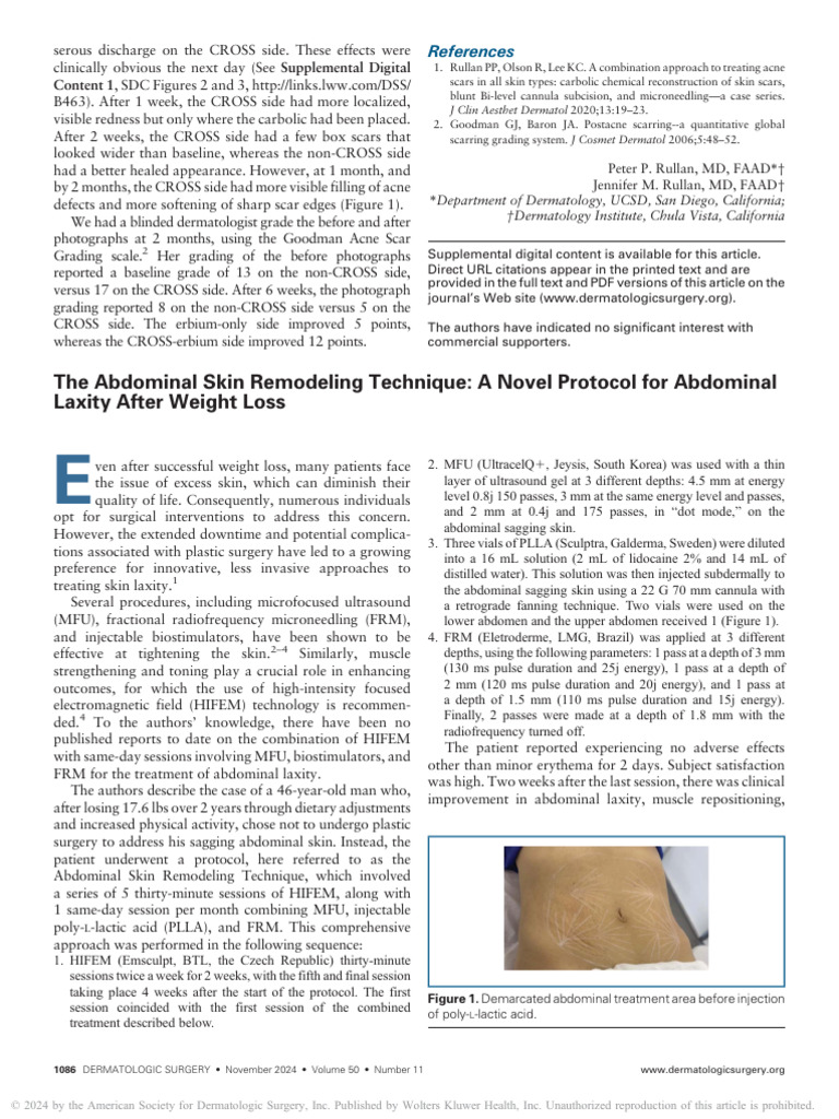 The Abdominal Skin Remodeling Technique A Novel.27 | PDF | Syringe ...