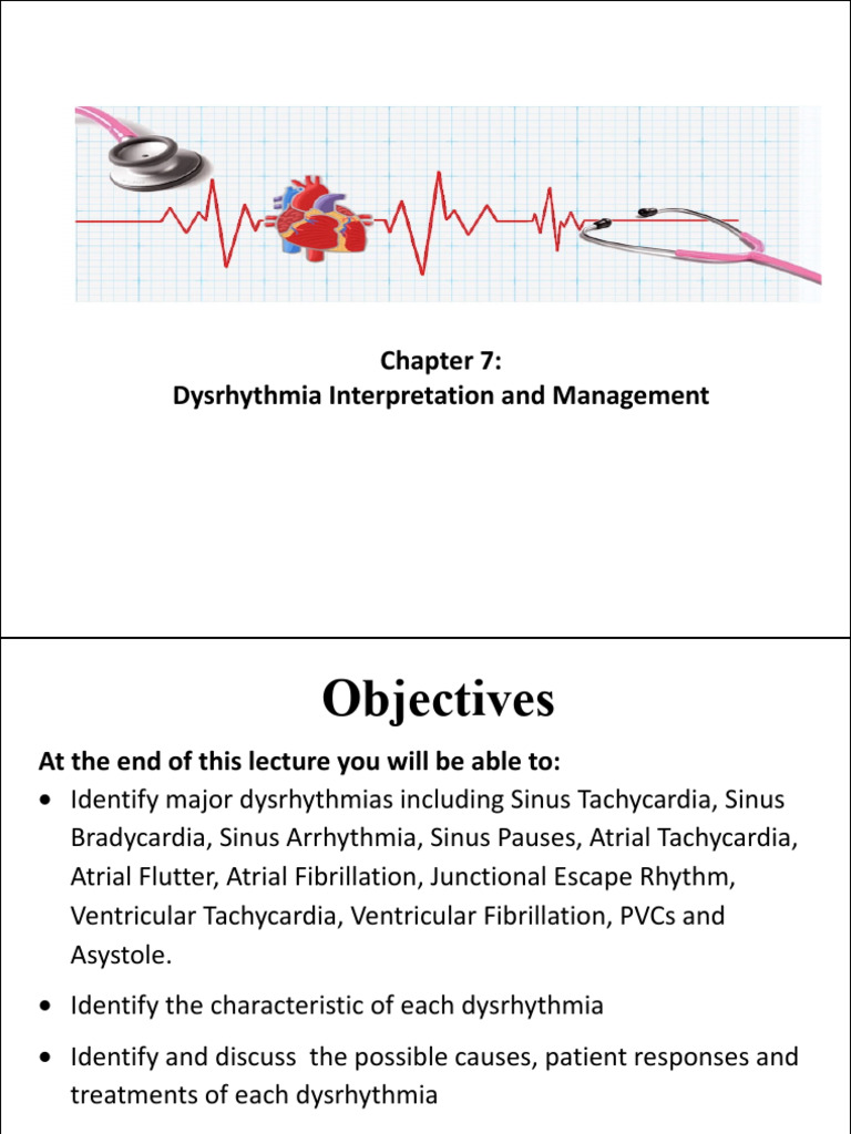 3. ECG Dysrhythmia Interpretation(2) | PDF | Electrocardiography ...