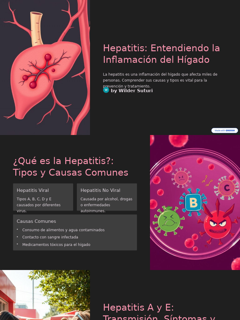 Hepatitis Entendiendo La Inflamacion Del Higado | PDF | Hepatitis | Virus