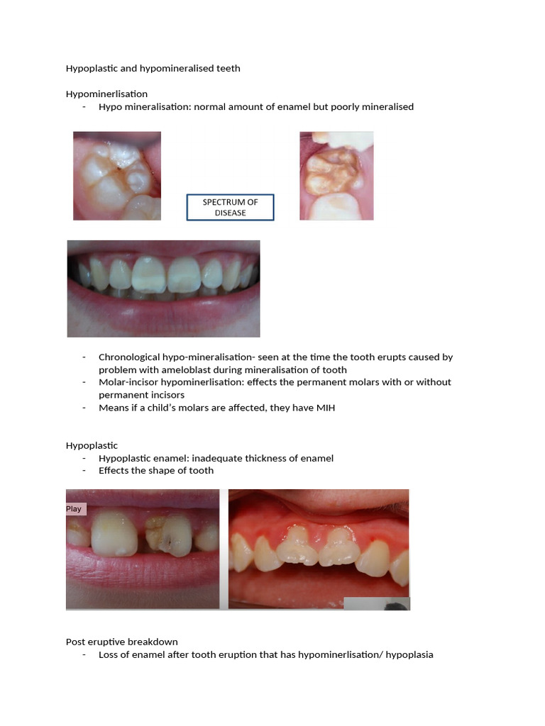 Understanding Hypoplastic and Hypomineralised Teeth | PDF | Tooth ...