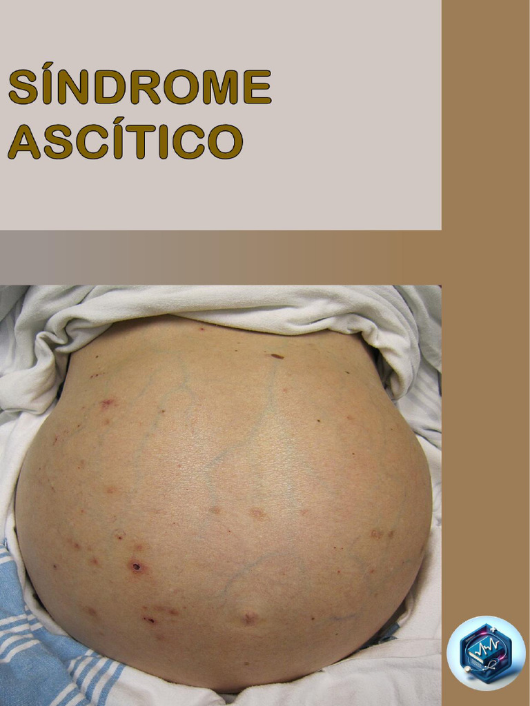 Síndrome Ascítico | PDF | Abdomen | El embarazo