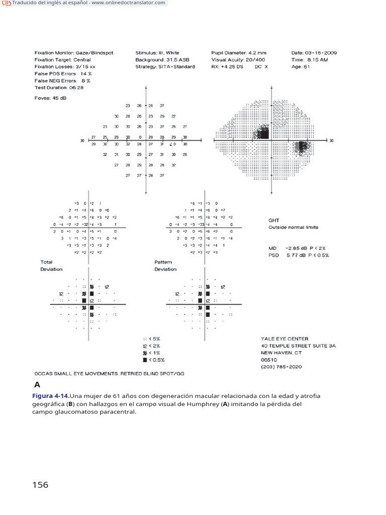 Thomas Walsh Visual Fields Ophth-4.en - Es | PDF | Visión | Sistema visual