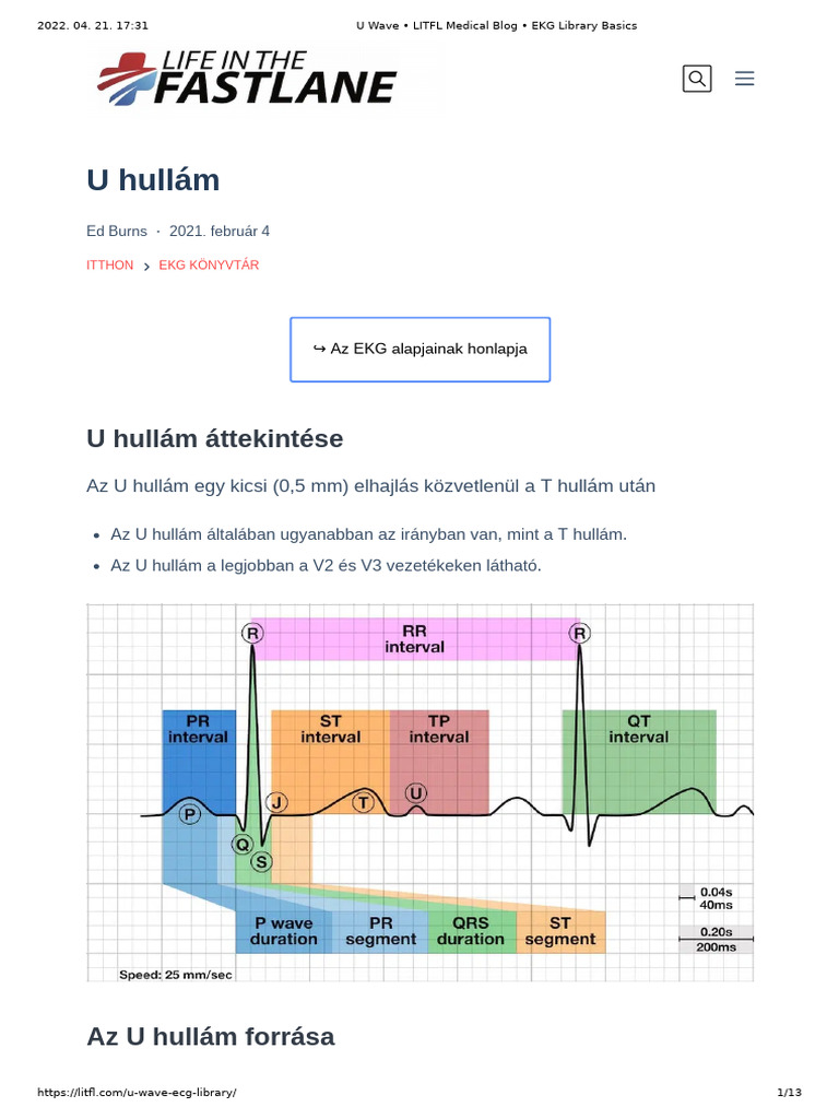 U Wave - LITFL Medical Blog - EKG Library Basics | PDF