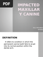 Canine Impaction and Its Management | PDF | Orthodontics | Dental Anatomy
