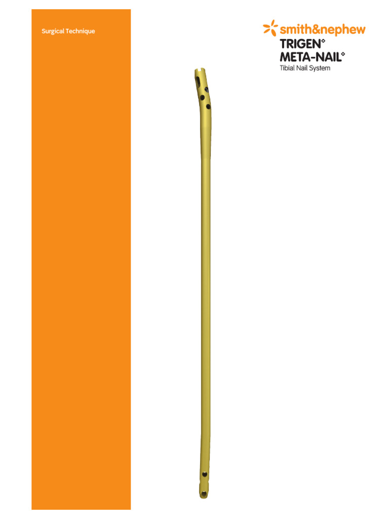 TRIGEN™ META-NAIL™ Surgical Technique Guide | PDF | Screw | Drill