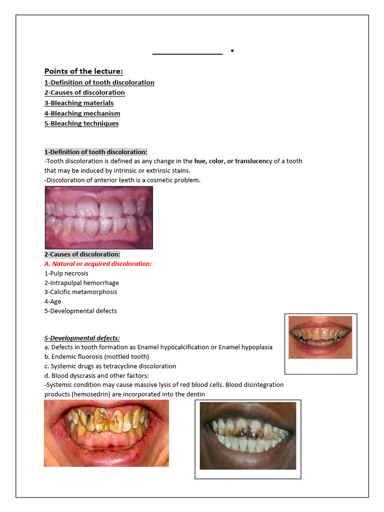 Endo Tooth Bleaching Husam | PDF | Tooth Enamel | Bleach