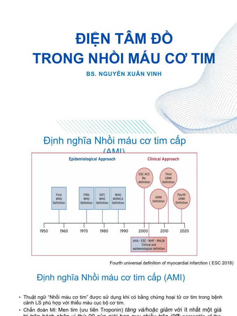Bản sao ECG trong NMCT | PDF