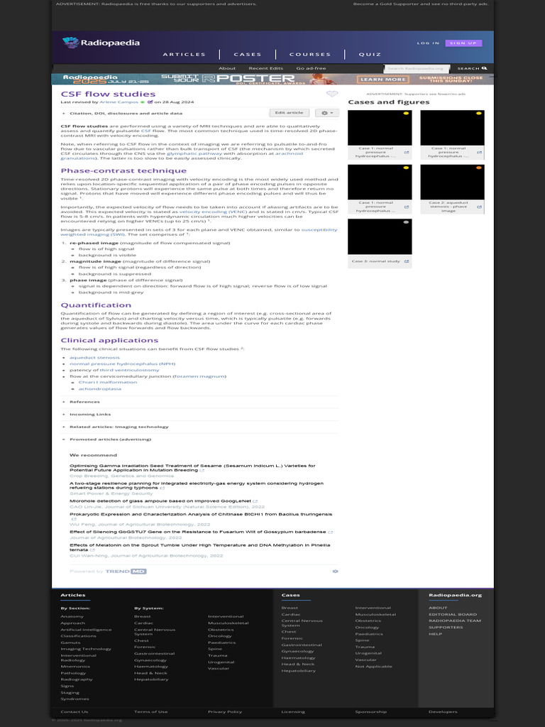 CSF Flow Studies - Radiology Reference Article | PDF | Cerebrospinal ...