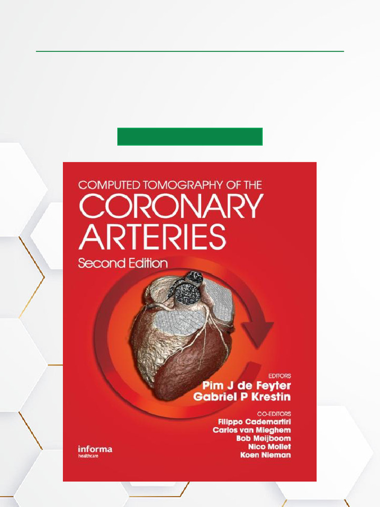 Computed Tomography of The Coronary Arteries, 2nd Edition ISBN ...