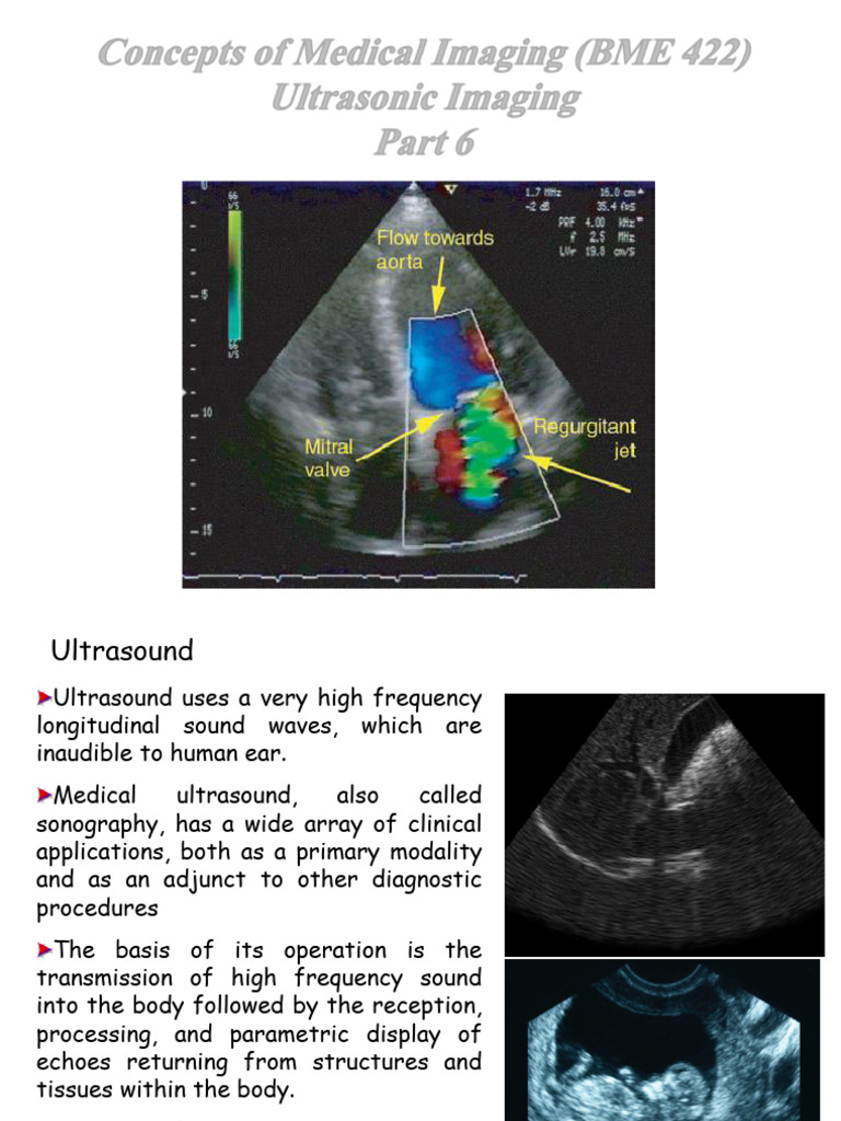 Part 6 - Ultrasound Imaging | PDF | Waves | Ultrasound