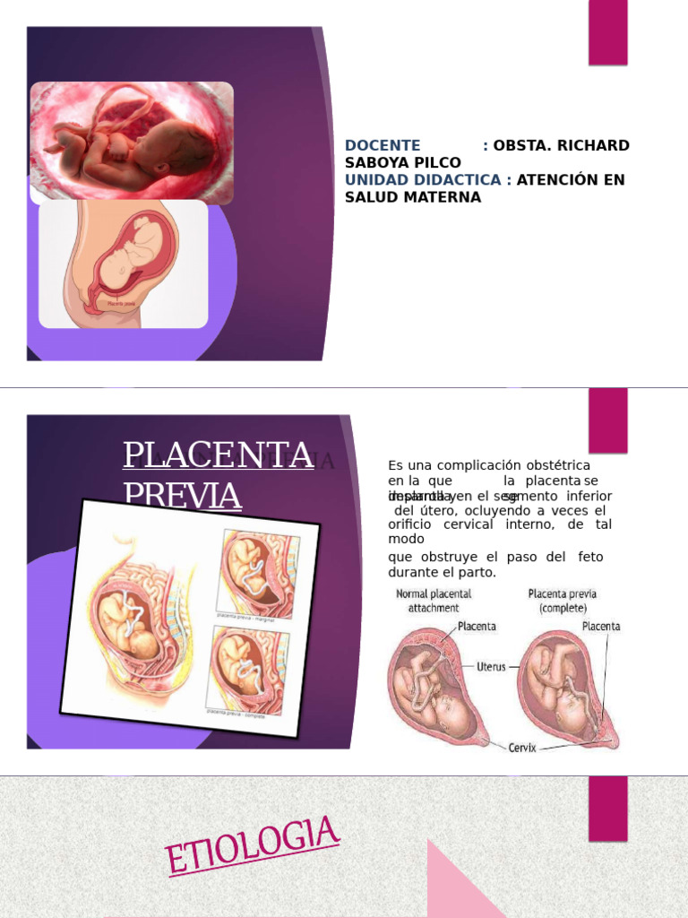 Placenta Previa | PDF | Placenta | Parto