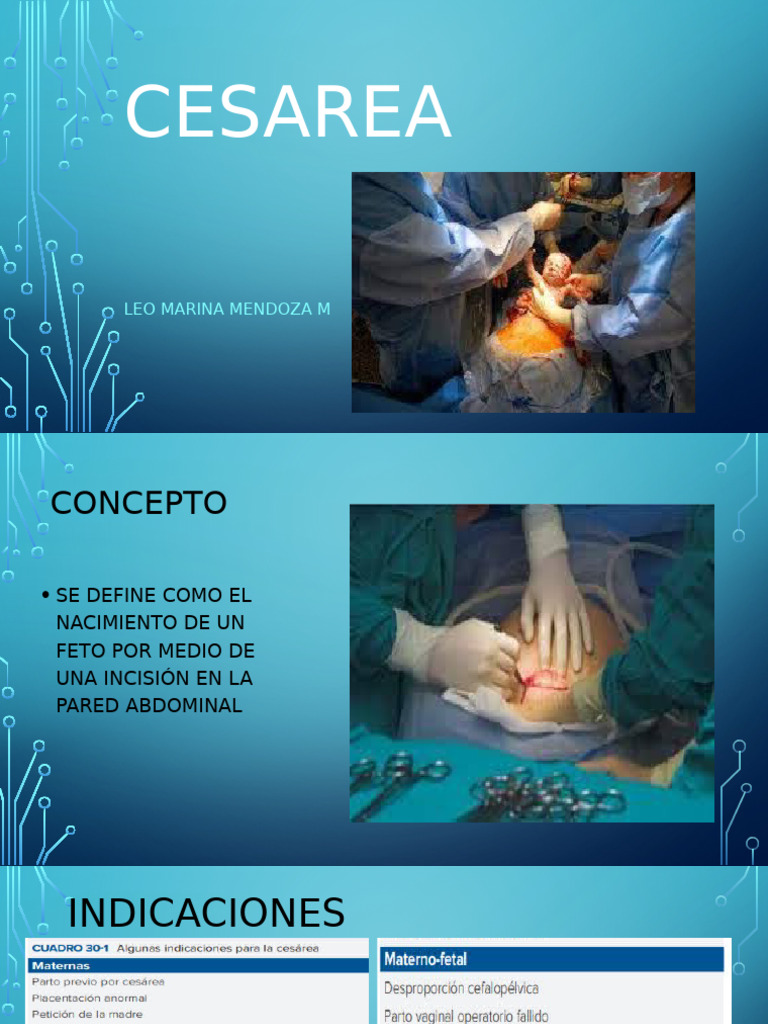 Tipos y Preparación para Cesárea | PDF | Parto | Seccion de cesárea