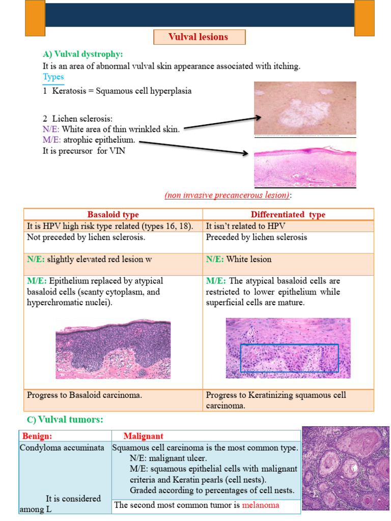 L30 Pathology Of Female Genital Tract (Pathology-4) | PDF | Medical Specialties | Diseases And ...