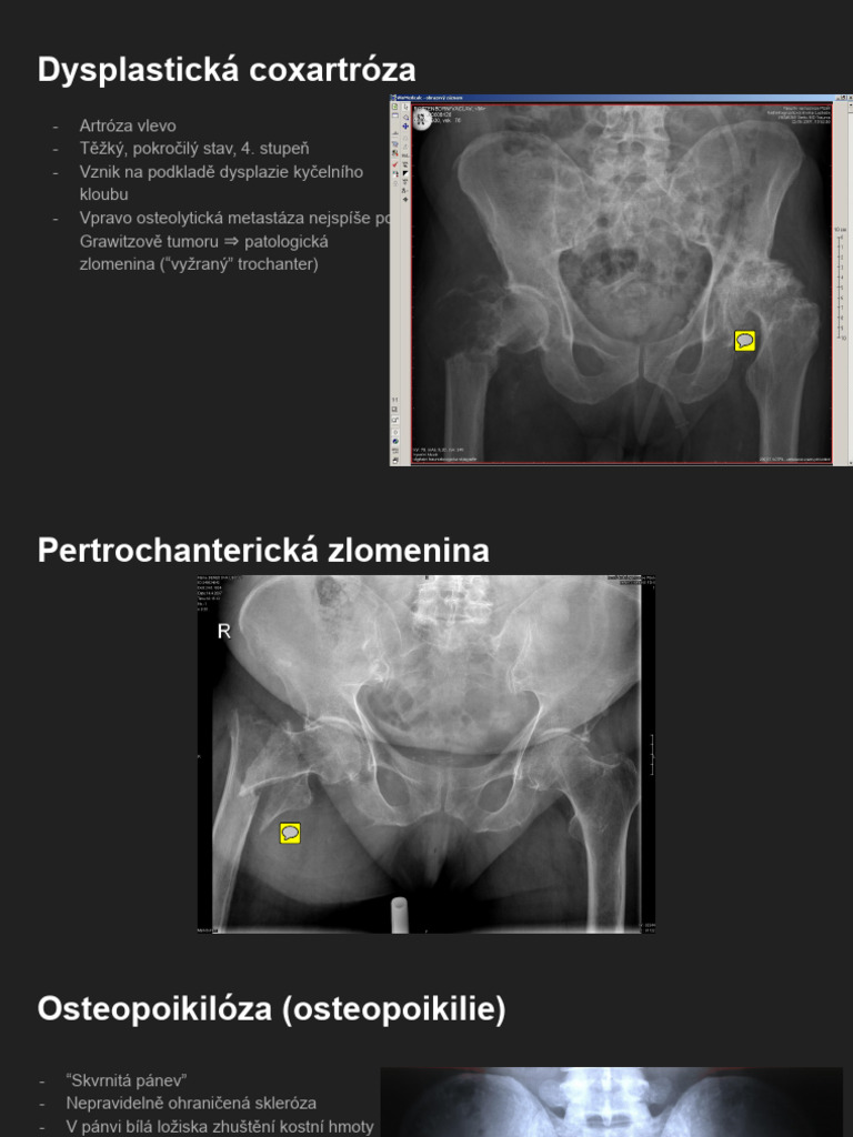 RTG-snímky-ortopedie_removed_organized | PDF
