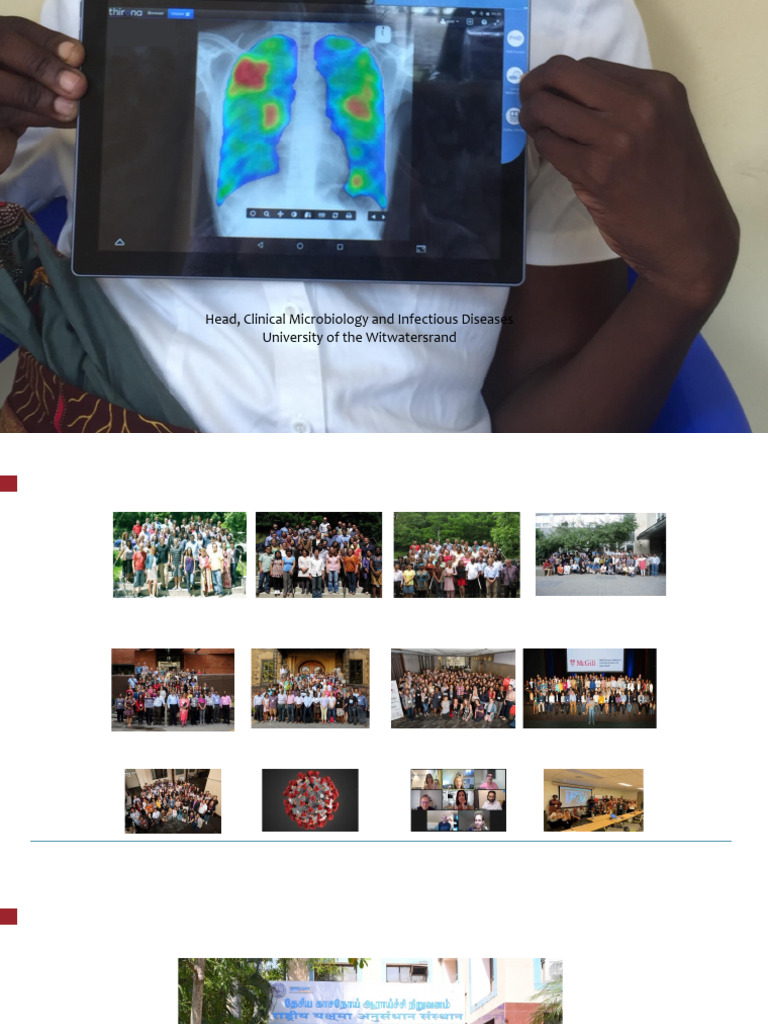 Advanced TB Diagnosis Strategies 2024 | PDF | Tuberculosis | Global Health