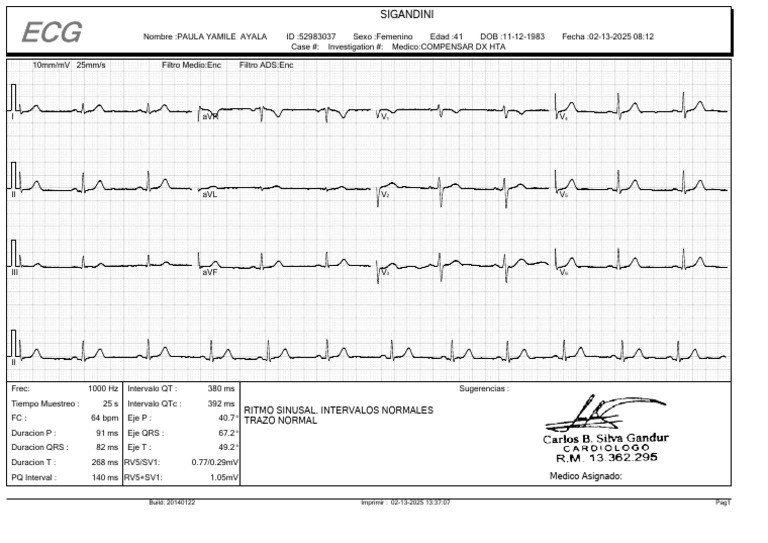 Informe ECG: Ritmo y Valores Normales | PDF