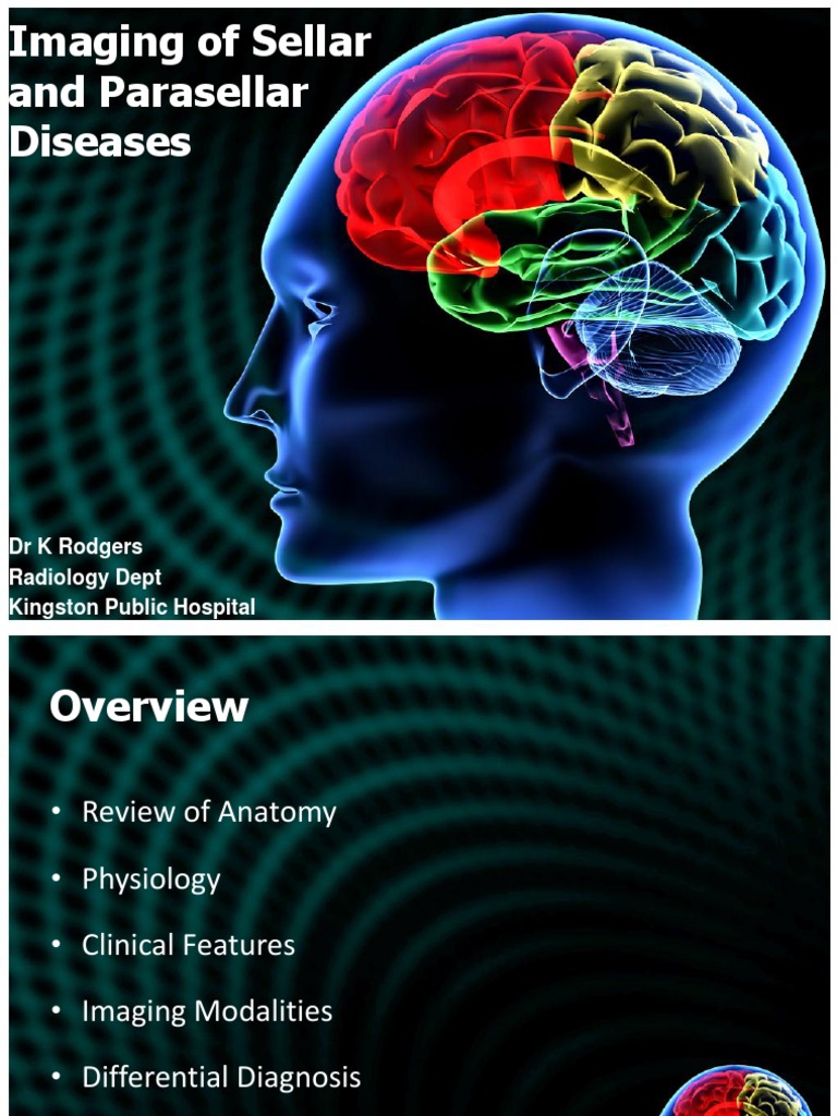 A Comprehensive Review of Imaging Features and Differential Diagnosis ...