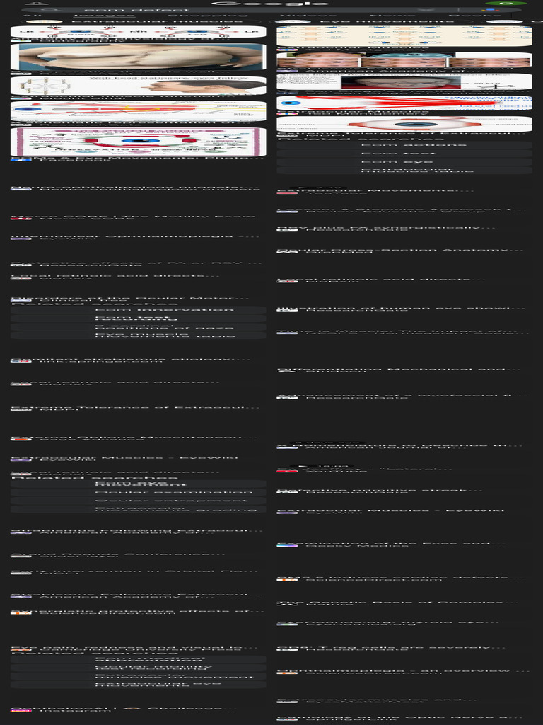 Eom Defect - Google Search | PDF | Ophthalmology | Medical Specialties