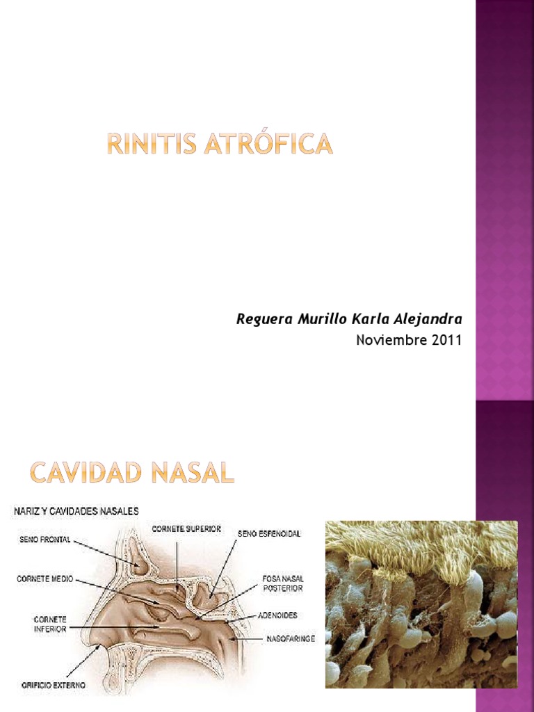 Comprehensive Review of Rhinitis Atrophic: Etiology, Pathophysiology ...