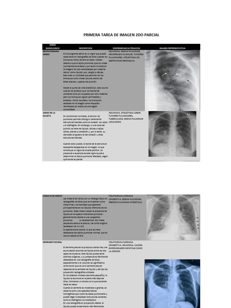 1ra Tarea de Imagen 2do Parcial | PDF | Pulmón | Neumonía