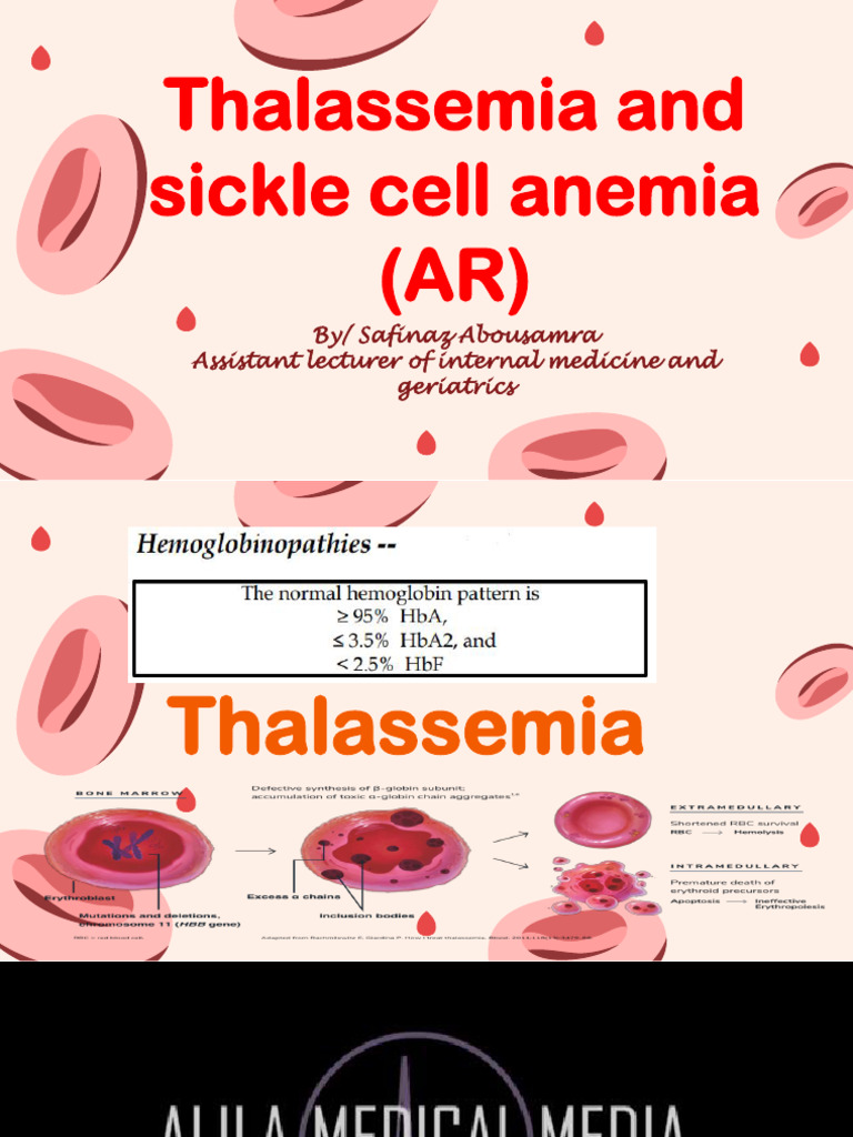 Sickle Cell Anemia and Thalassemia | PDF | Anemia | Opioid