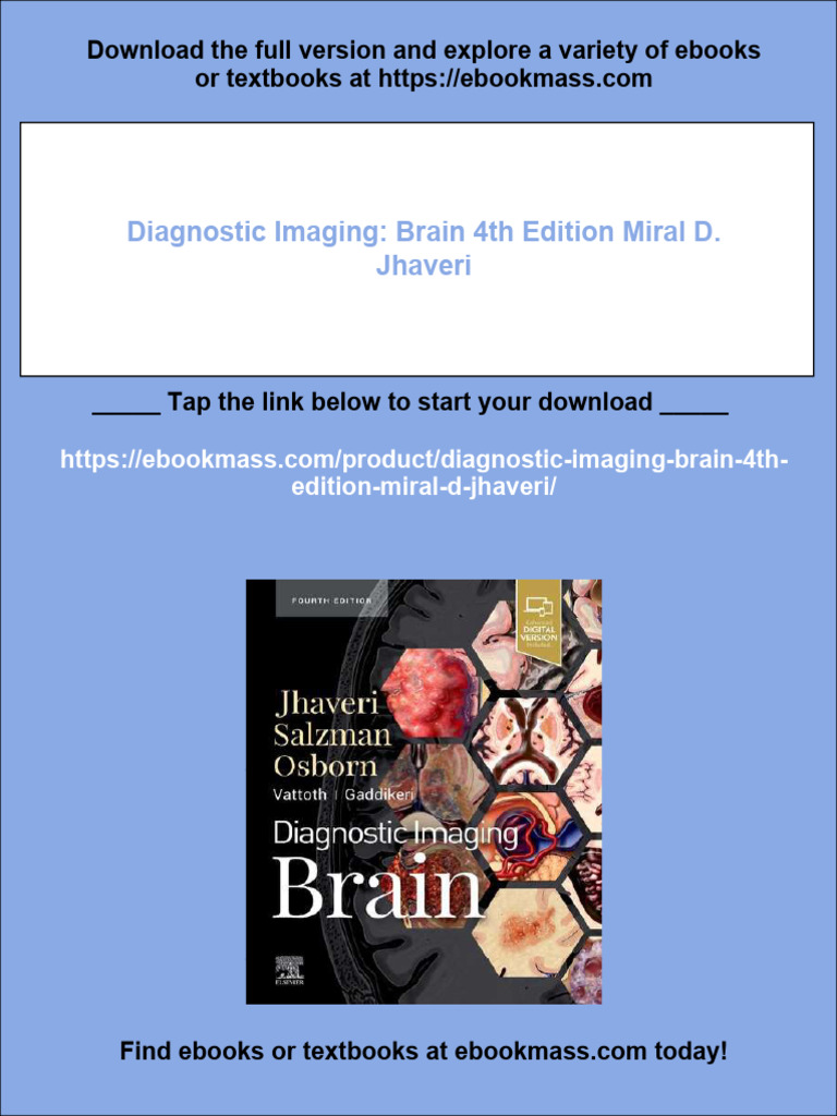 Brain Mri | PDF