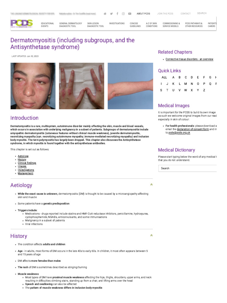 Dermatomyositis (And Polymyositis) | PDF | Medicine | Human Diseases ...