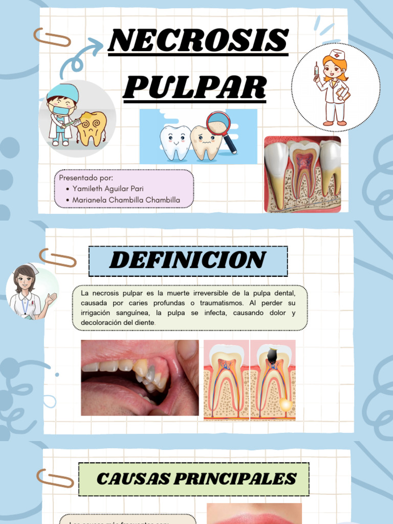 Necrosis Pulpar: Causas y Consecuencias | PDF | Odontología | Inflamación