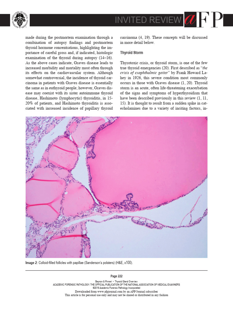 An Overview of The Thyroid Gland and Thyroid-Related Deaths For The ...