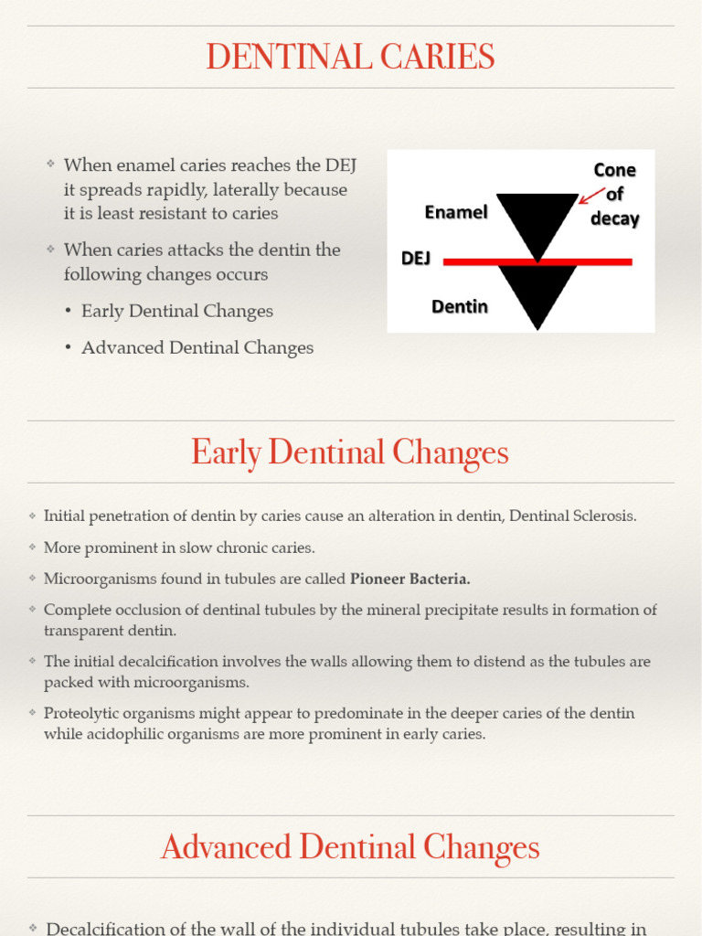 Zones of Dentinal Caries Explained | PDF | Dentin | Mouth