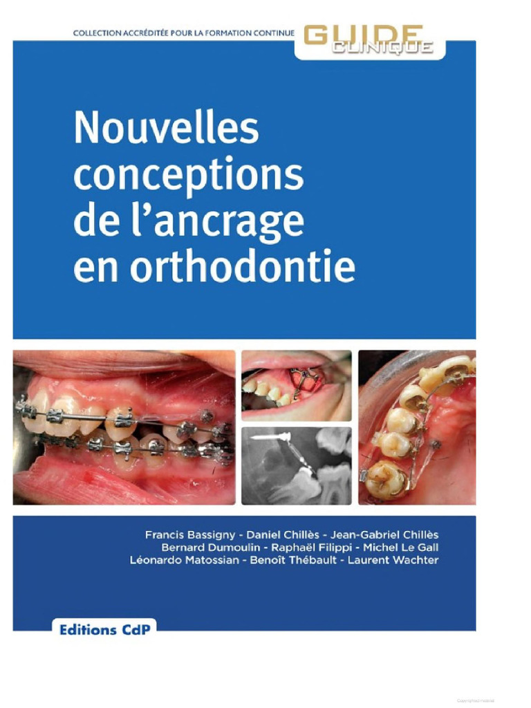 Nouvelles Conceptions de l Ancrage en Orthodontie 250523 113710 | PDF
