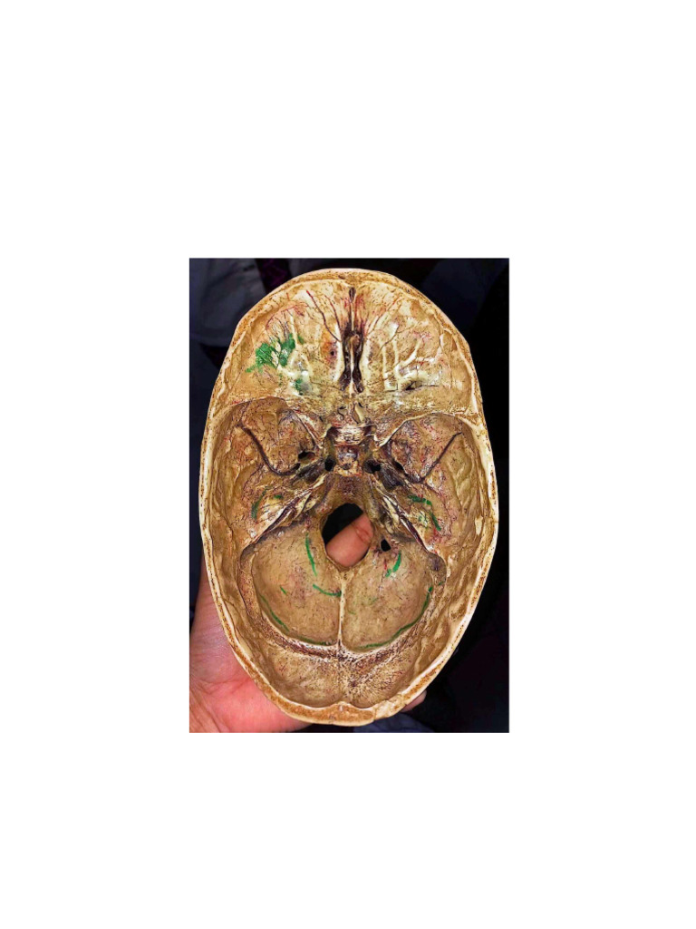 Base of Skull | PDF