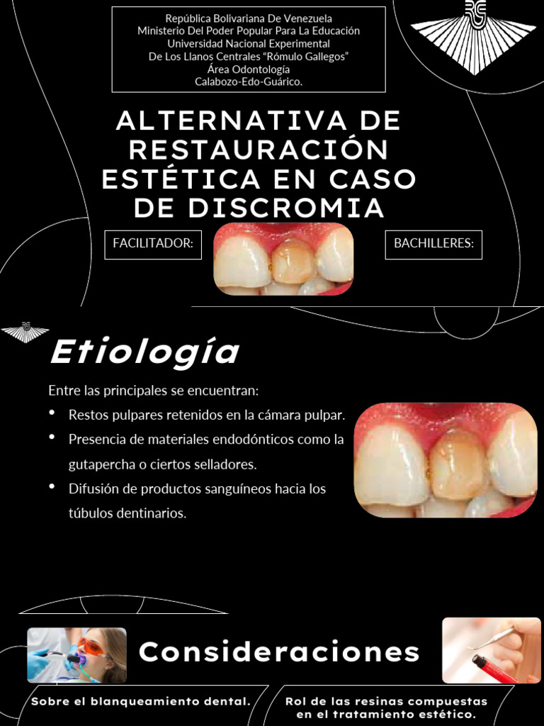 Discromia Dental | PDF