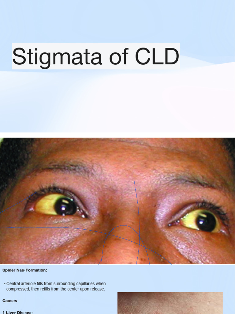 Stigmata Ossdddisease | PDF