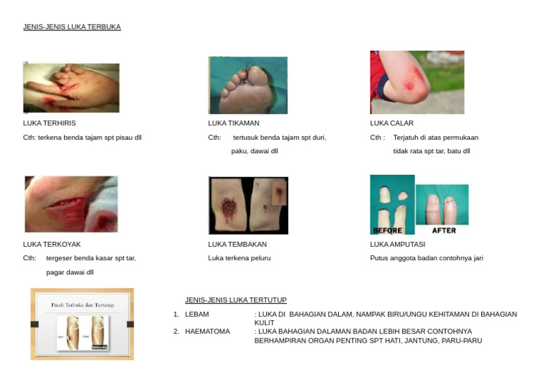 Jenis Jenis Luka | PDF
