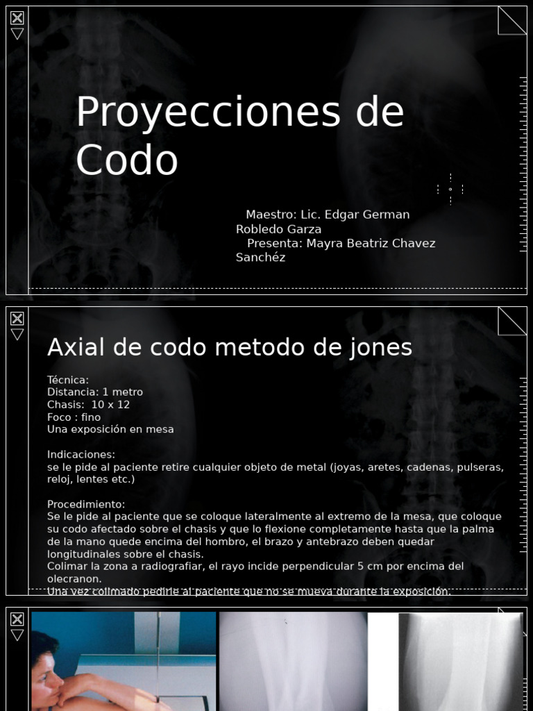 Proyección Axial del Codo | PDF | Codo | Extremidades (anatomía)