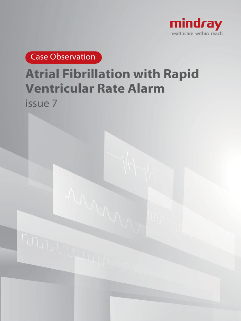 Atrial Fibrillation With Rapid Ventricular Rate Alarm | PDF