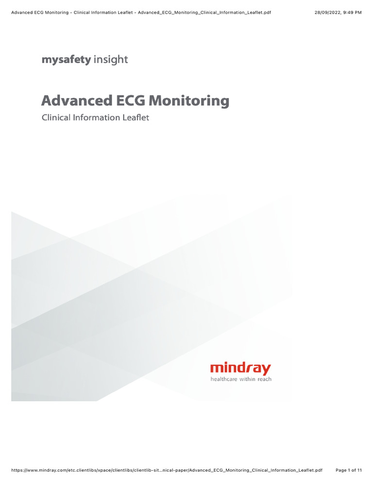 Advanced ECG Monitoring - Clinical Information Leaflet - Advanced - ECG ...