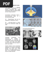 Lower Extremity Runoff CTA Protocol | PDF | Ct Scan | Angiography
