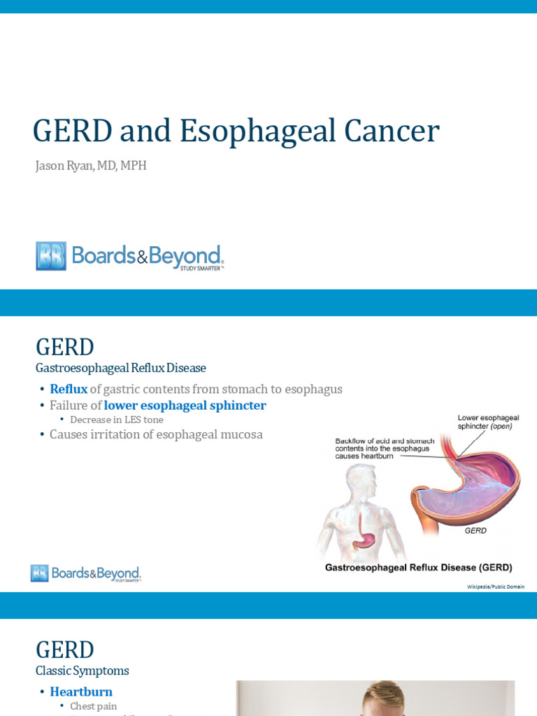 GERD and Esophageal Cancer Atf | PDF | Gastroesophageal Reflux Disease ...