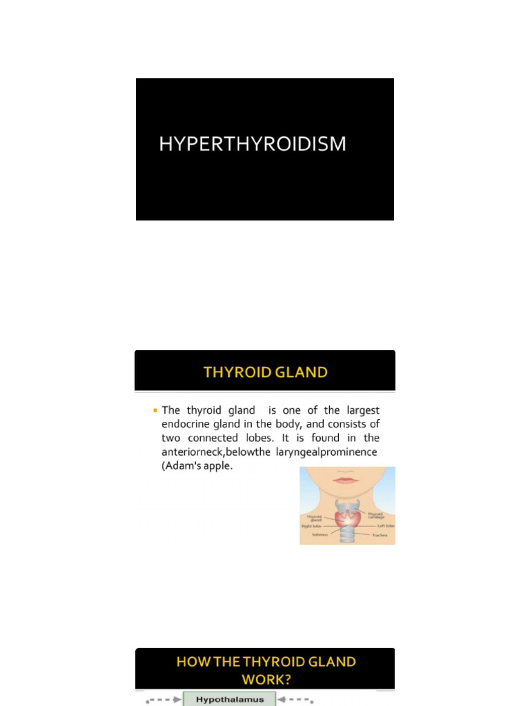Hyperthyroidism | PDF