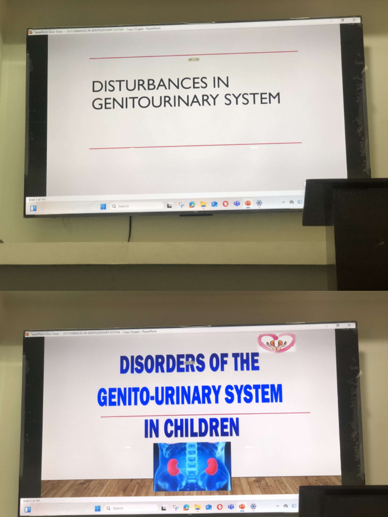 Genitourinary System Pediatric Nursing (AT RISK) | PDF
