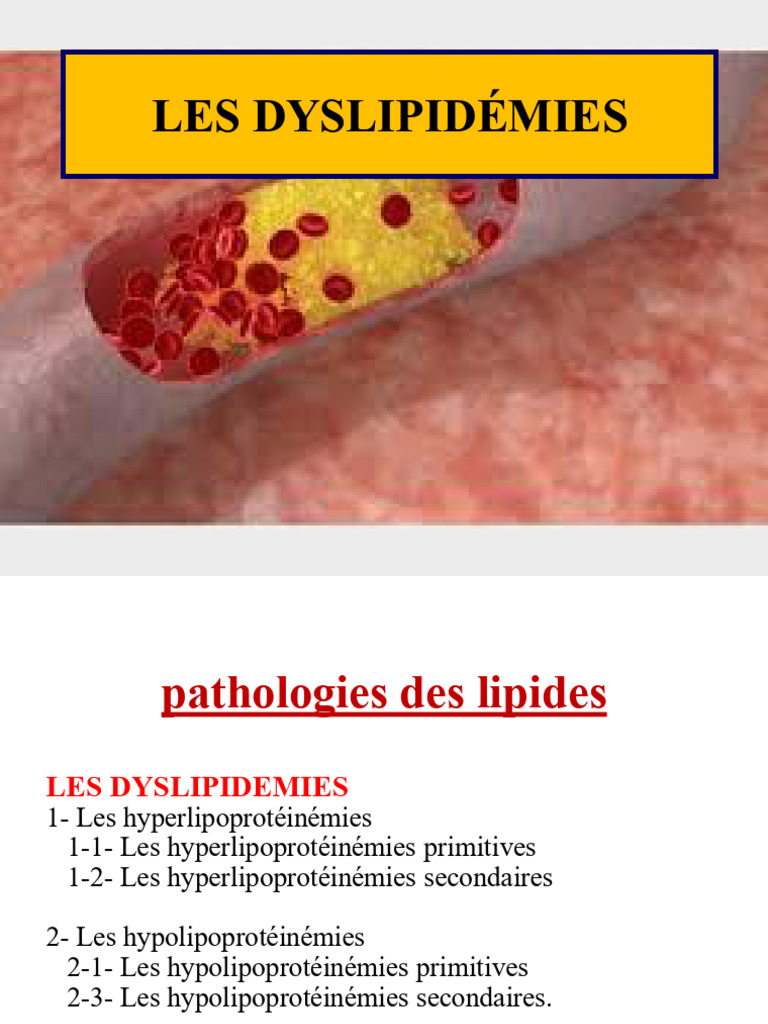 Dyslipidémies et Xanthomatose Éruptive | PDF | Cholestérol ...