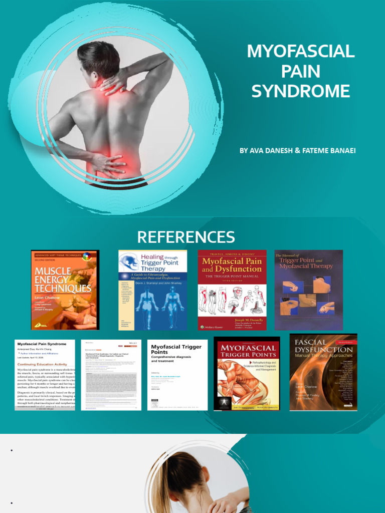 Myofascial Pain Syndrome 2 | PDF | Myofascial Trigger Point | Pain