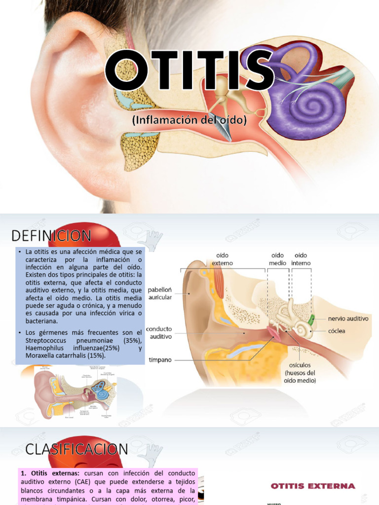 OTITIS | PDF | Oído | Resfriado comun