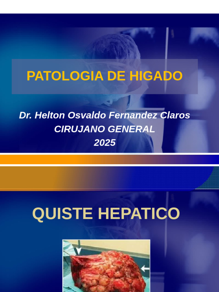 Quiste Hepatico, Hidatidico y Absceso Hepatico | PDF